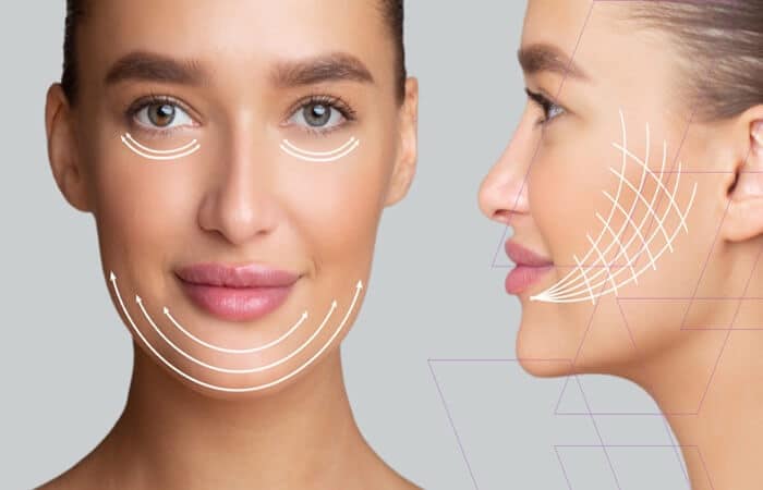 حقن الفيلر | النتائج والنصائح | كوارتز كلينك - اسطنبول